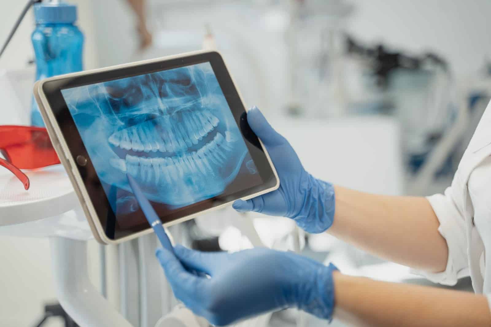 5 Best Dentist Disability Insurance Policies | LeverageRx
